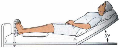 Movilización del Paciente Hospitalizado.