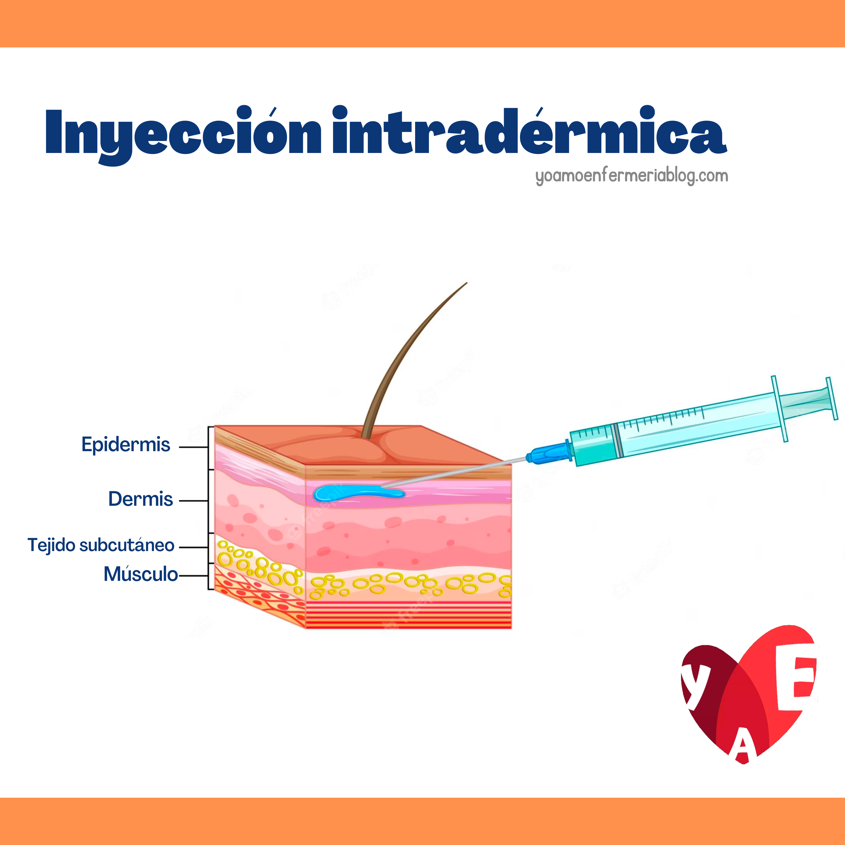 Inyecciones (material, anatomía y sitios de aplicación)