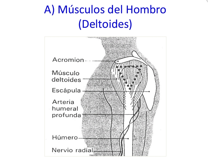 Inyecciones (material, anatomía y sitios de aplicación)