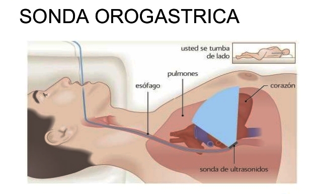 Fármacos Por Sonda Nasogástrica Preparación Y Administración