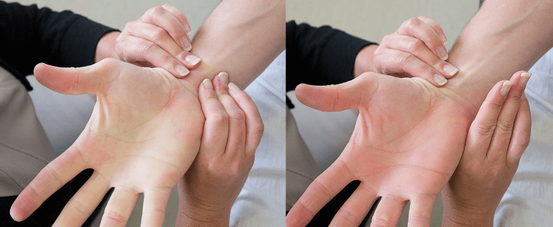 Prueba o test de Allen modificada